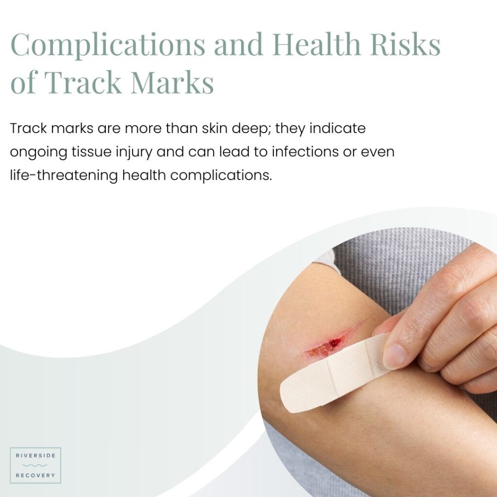 Track Marks: Identification & Recovery Information | Riverside Recovery ...