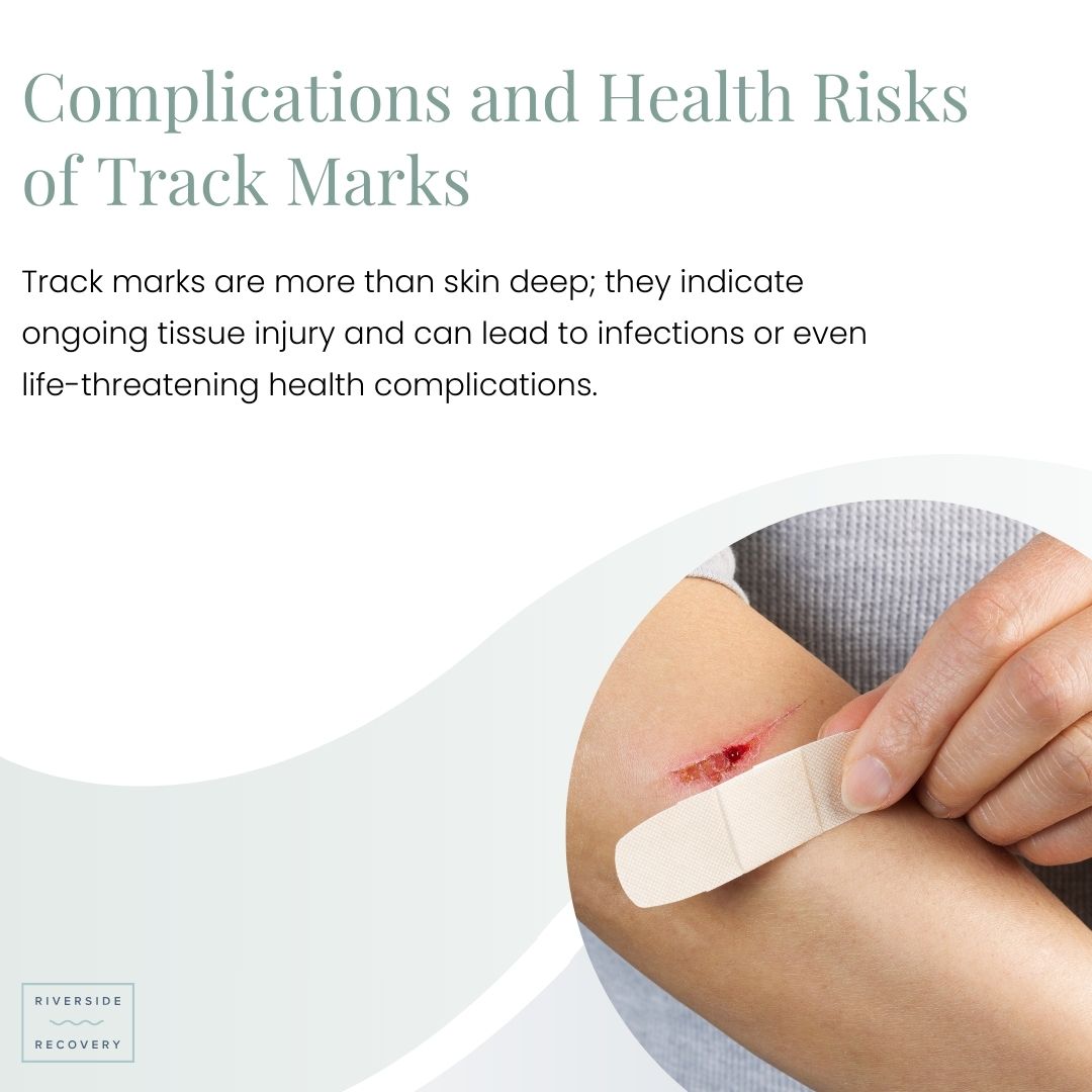 Track Marks: Identification & Recovery Information | Riverside Recovery ...