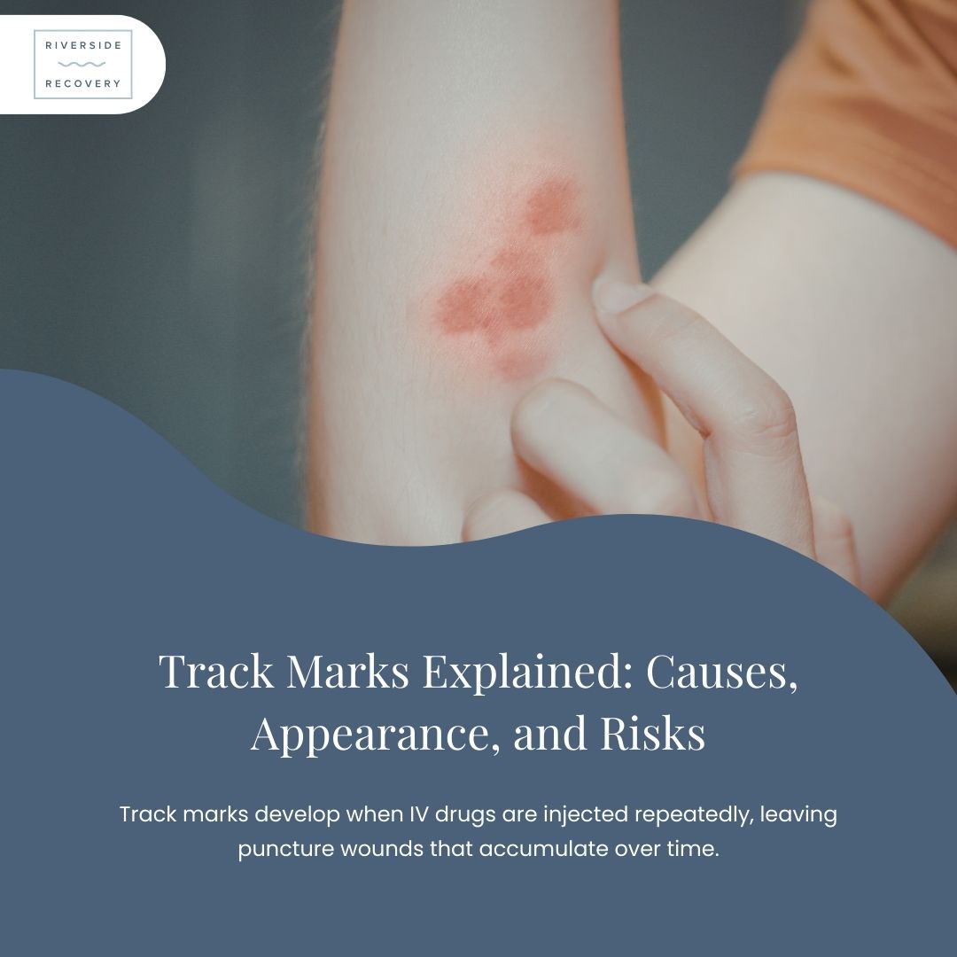Track Marks: Identification & Recovery Information | Riverside Recovery ...